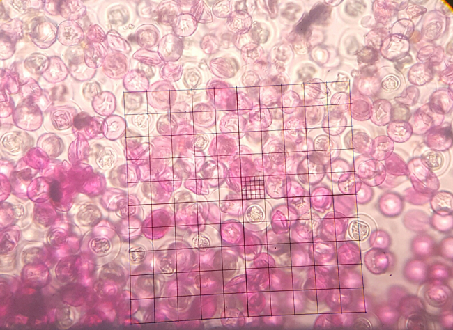 Cedar count reaches second highest level in recorded history | Respro ...